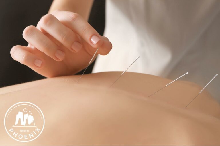 The Top 11 Acupuncture Centers in Phoenix [2026 ]